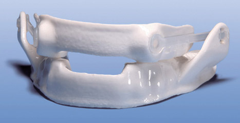 Technology | Innovative Dental Sleep Reno